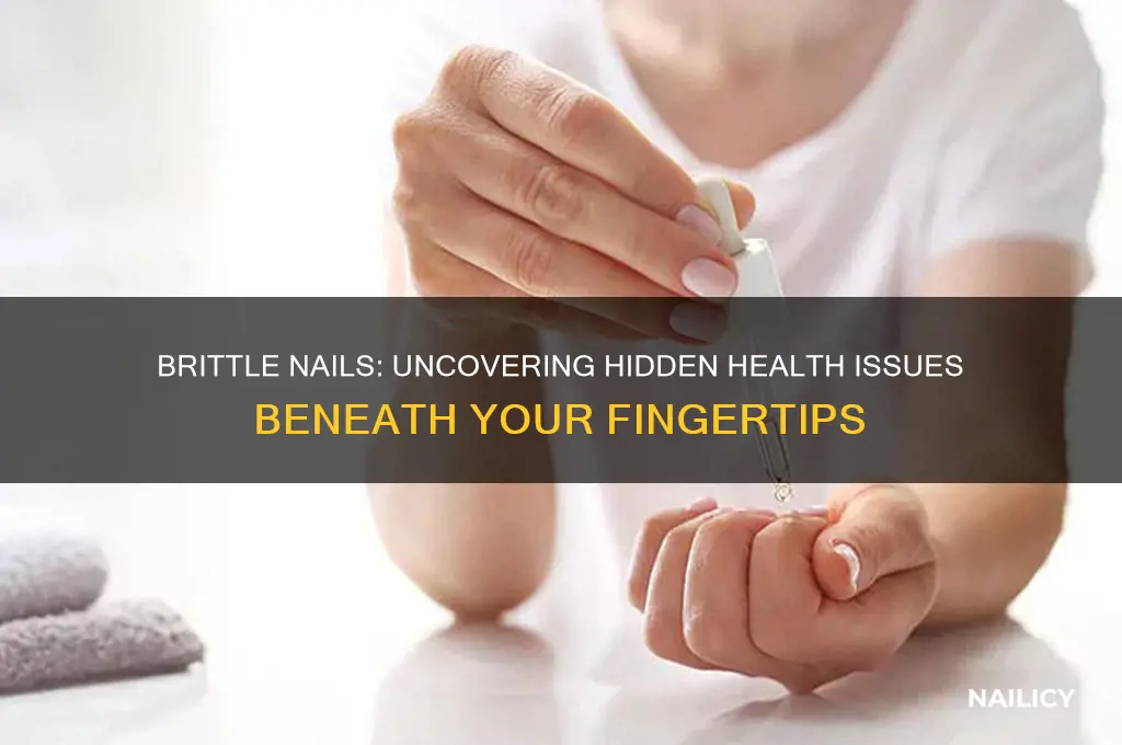 Brittle Nails: Uncovering Hidden Health Issues Beneath Your Fingertips ...