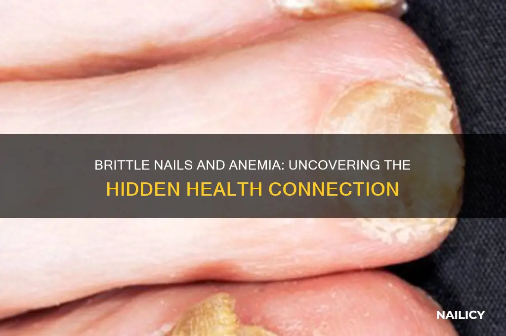 Brittle Nails And Anemia: Uncovering The Hidden Health Connection | Nailicy