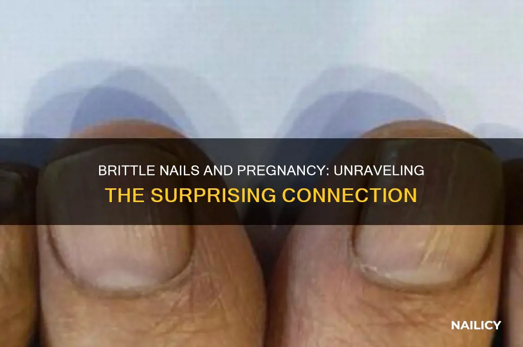 Brittle Nails And Pregnancy: Unraveling The Surprising Connection | Nailicy
