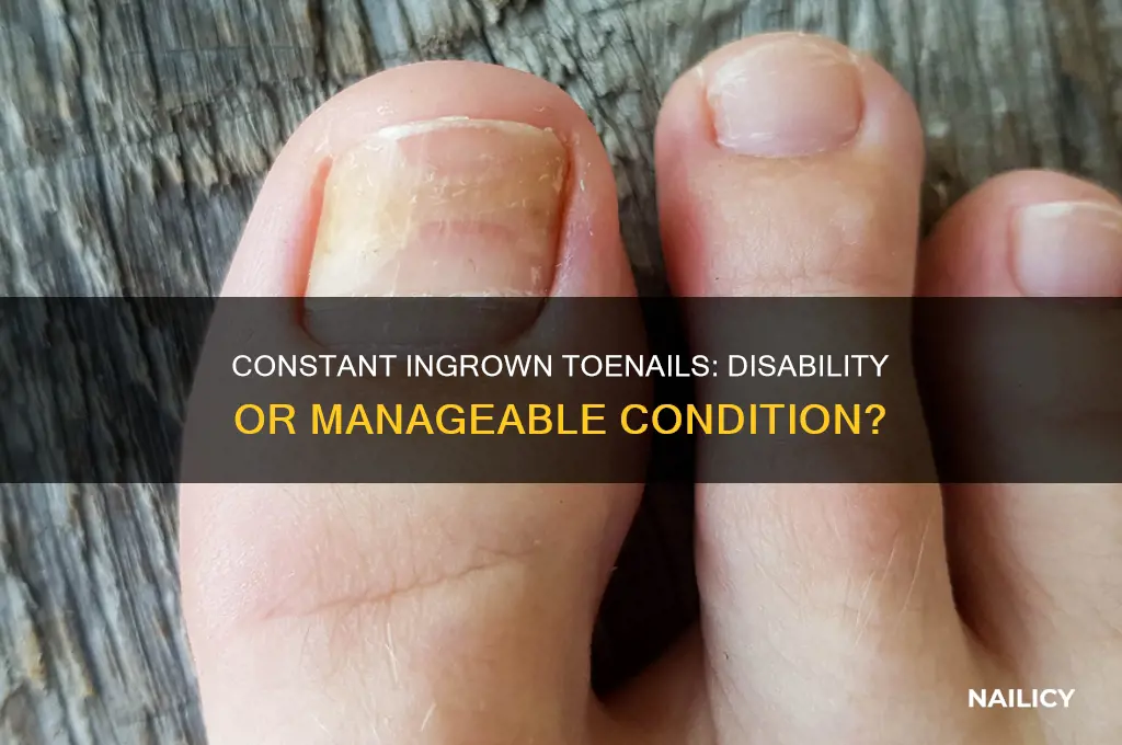 Constant Ingrown Toenails: Disability Or Manageable Condition? | Nailicy
