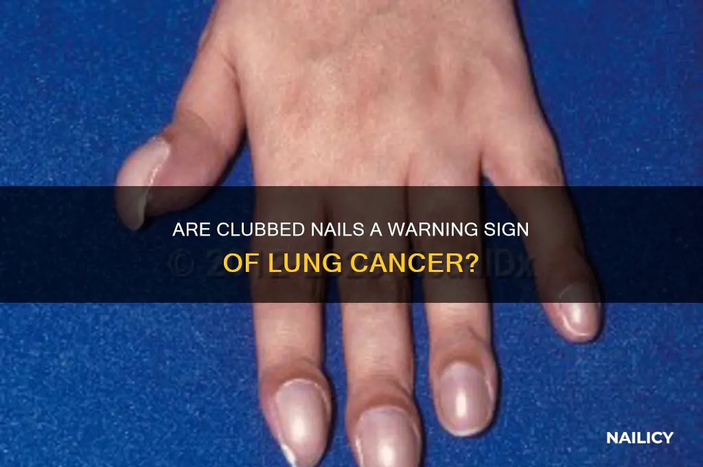 Are Clubbed Nails A Warning Sign Of Lung Cancer? | Nailicy
