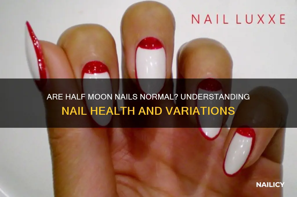 Are Half Moon Nails Normal? Understanding Nail Health And Variations ...
