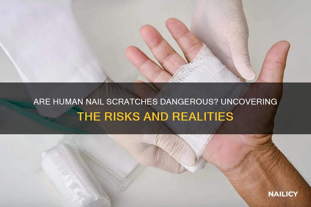 Are Human Nail Scratches Dangerous? Uncovering The Risks And Realities ...