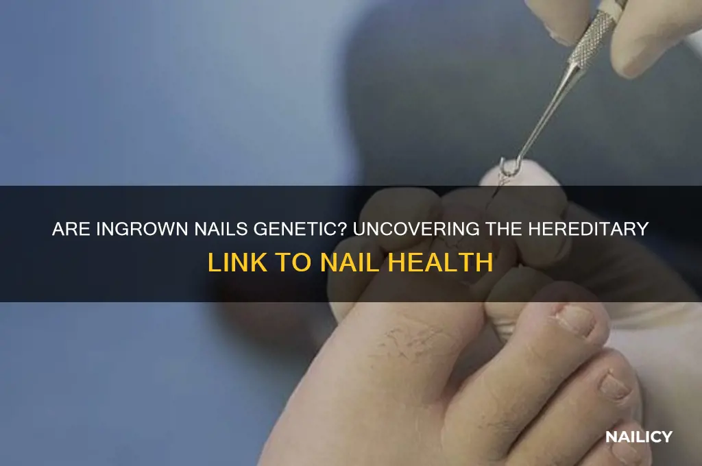 Are Ingrown Nails Genetic? Uncovering The Hereditary Link To Nail ...
