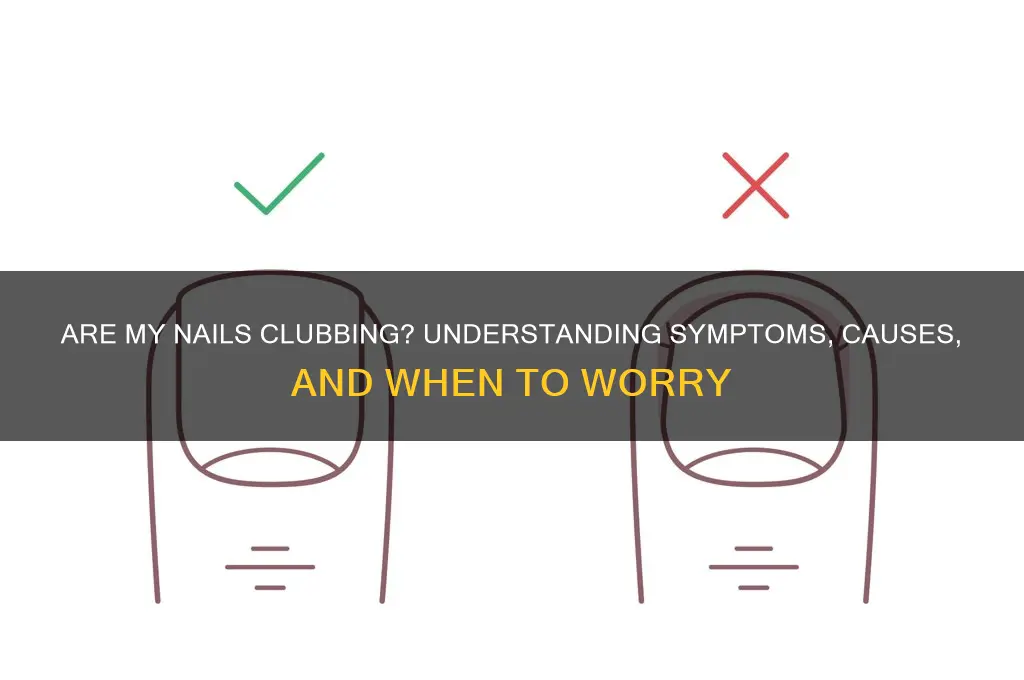 Are My Nails Clubbing? Understanding Symptoms, Causes, And When To ...