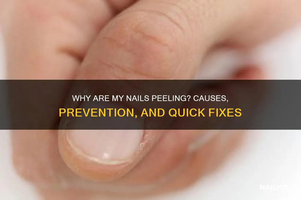 Why Are My Nails Peeling? Causes, Prevention, And Quick Fixes | Nailicy