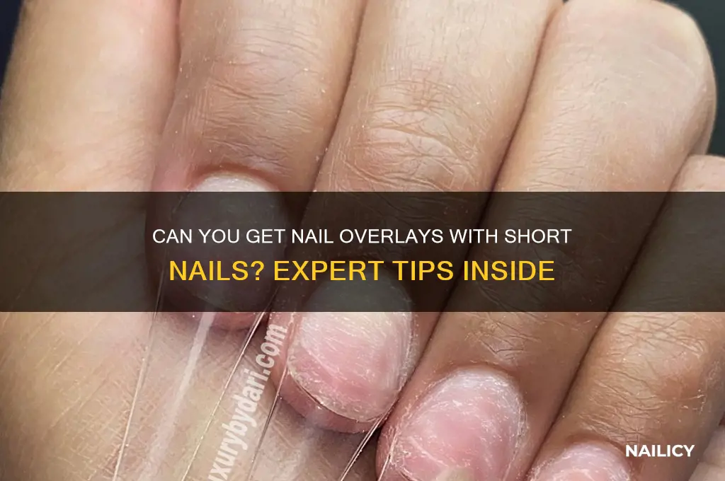 Can You Get Nail Overlays With Short Nails? Expert Tips Inside | Nailicy