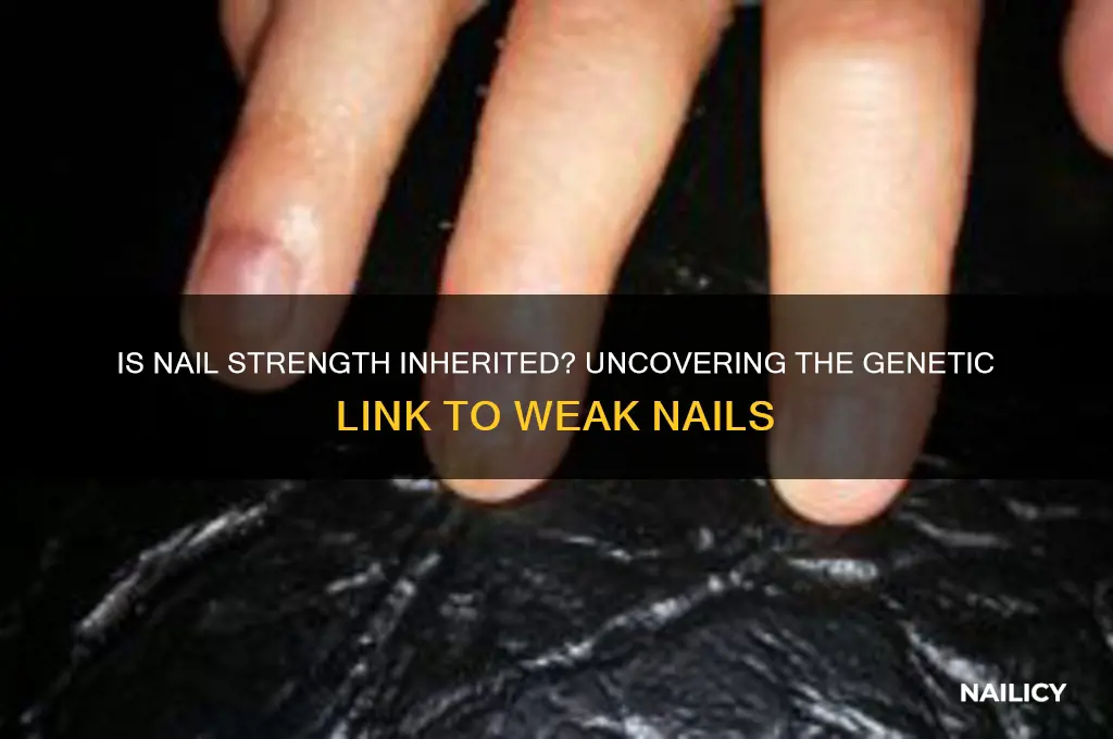 Is Nail Strength Inherited? Uncovering The Genetic Link To Weak Nails ...