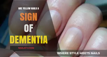 Yellow Nails And Diabetes: Uncovering The Surprising Connection | Nailicy
