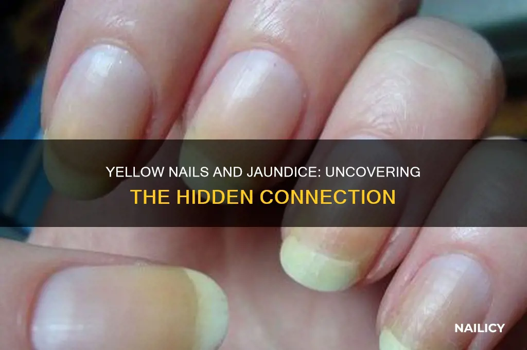 Yellow Nails And Jaundice: Uncovering The Hidden Connection | Nailicy