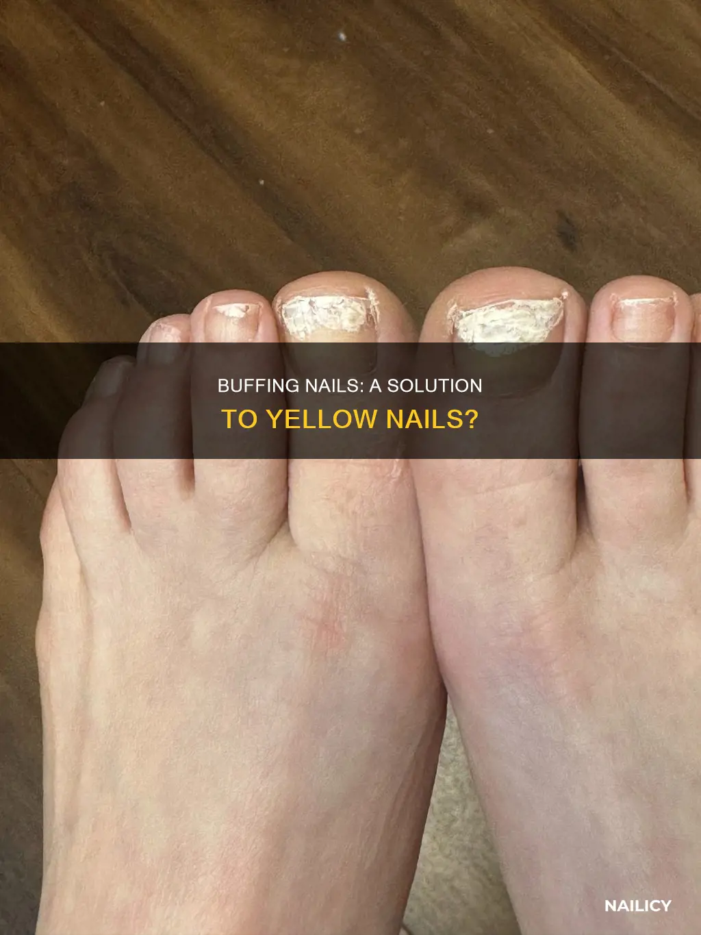 Buffing Nails: A Solution To Yellow Nails? | Nailicy