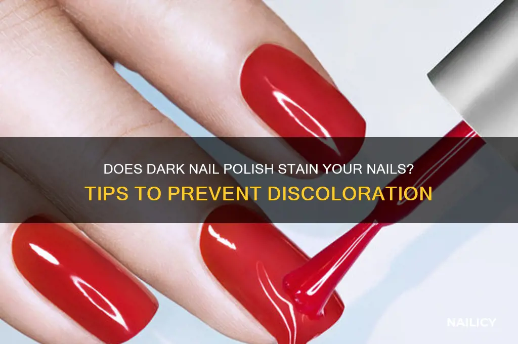 Does Dark Nail Polish Stain Your Nails? Tips To Prevent Discoloration ...