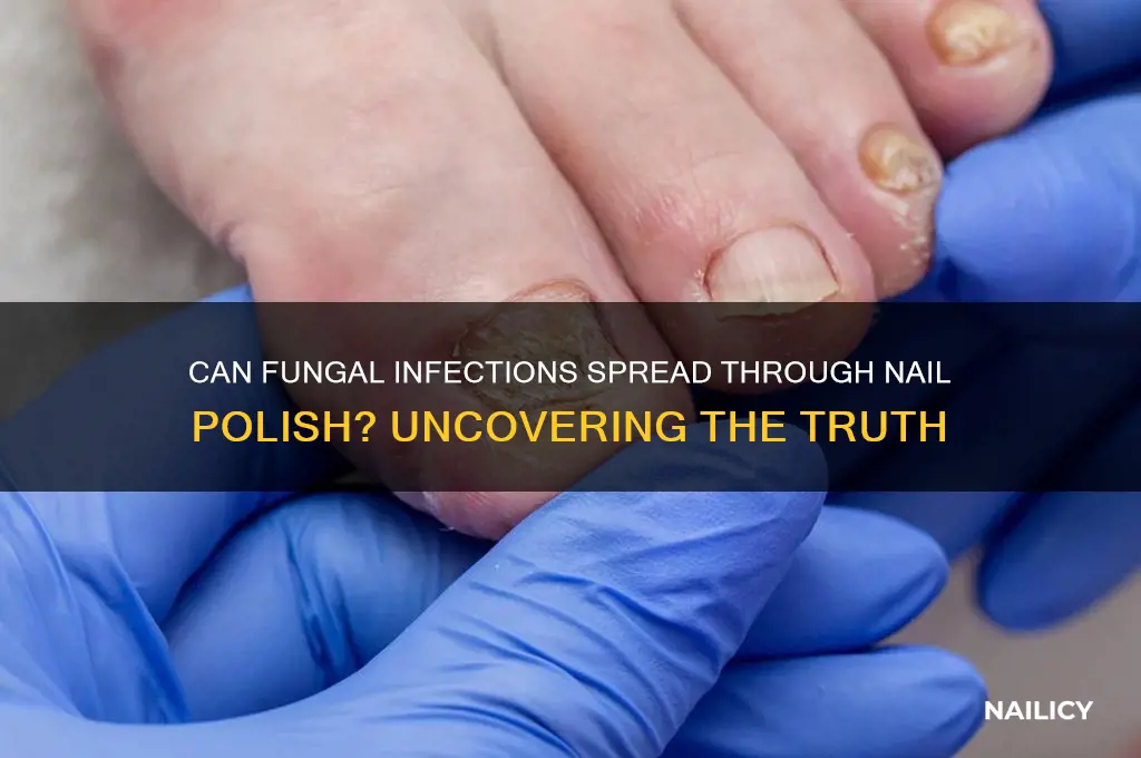 Can Fungal Infections Spread Through Nail Polish? Uncovering The Truth ...