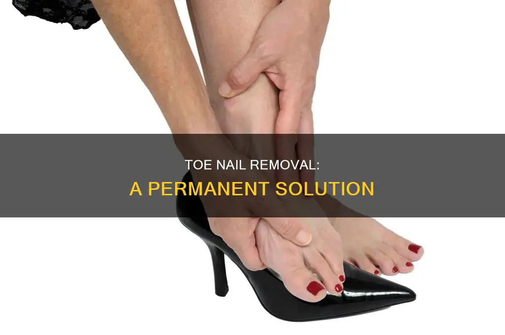 Toe Nail Removal: A Permanent Solution | Nailicy