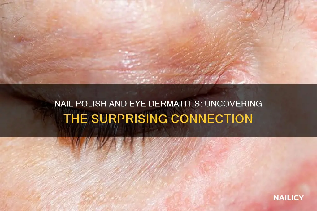 Nail Polish And Eye Dermatitis: Uncovering The Surprising Connection ...