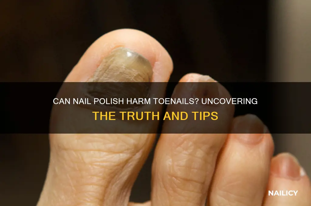 Can Nail Polish Harm Toenails? Uncovering The Truth And Tips | Nailicy