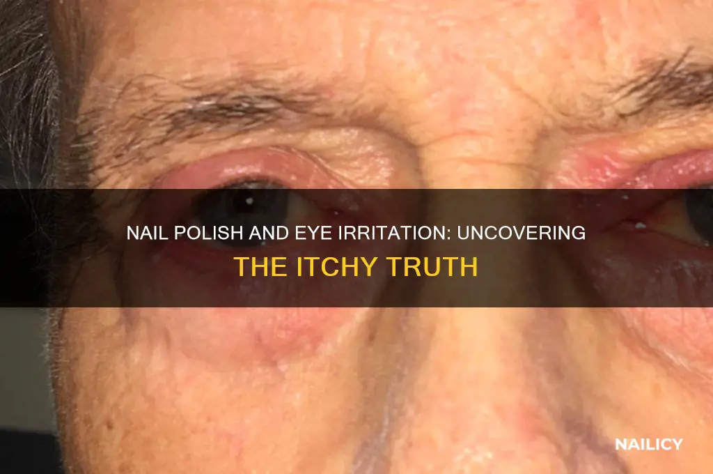Nail Polish And Eye Irritation: Uncovering The Itchy Truth | Nailicy