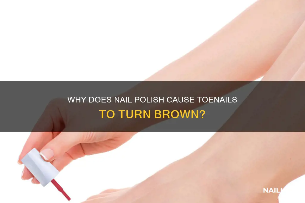 Why Does Nail Polish Cause Toenails To Turn Brown? | Nailicy