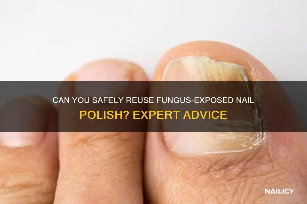 Can You Safely Reuse Fungus-Exposed Nail Polish? Expert Advice | Nailicy