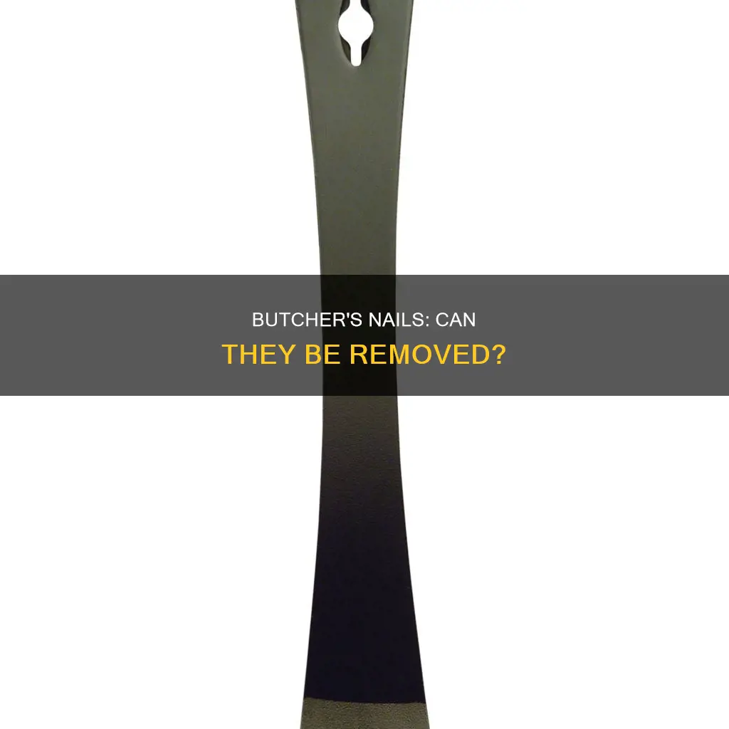 Butcher's Nails: Can They Be Removed? | Nailicy