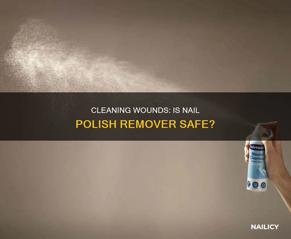 Cleaning Wounds: Is Nail Polish Remover Safe? | Nailicy