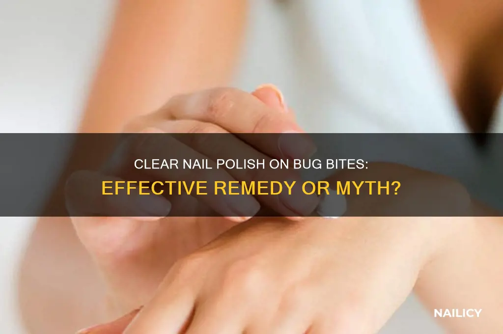 Clear Nail Polish On Bug Bites: Effective Remedy Or Myth? | Nailicy