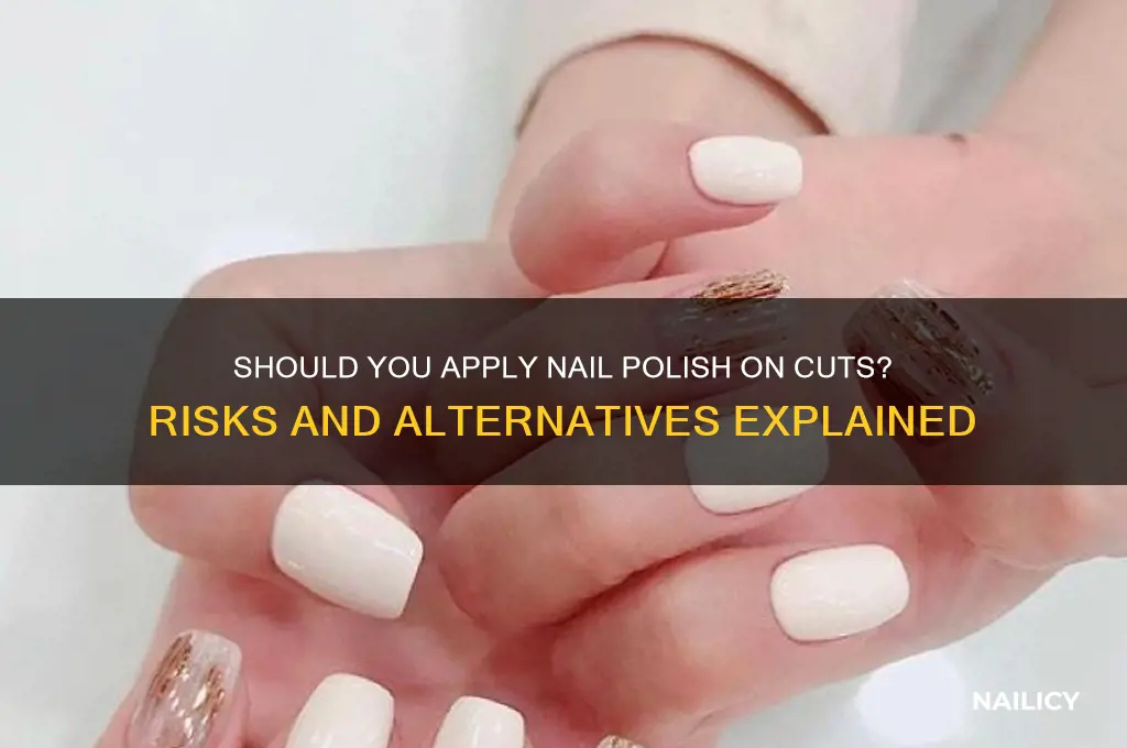 Should You Apply Nail Polish On Cuts? Risks And Alternatives Explained ...