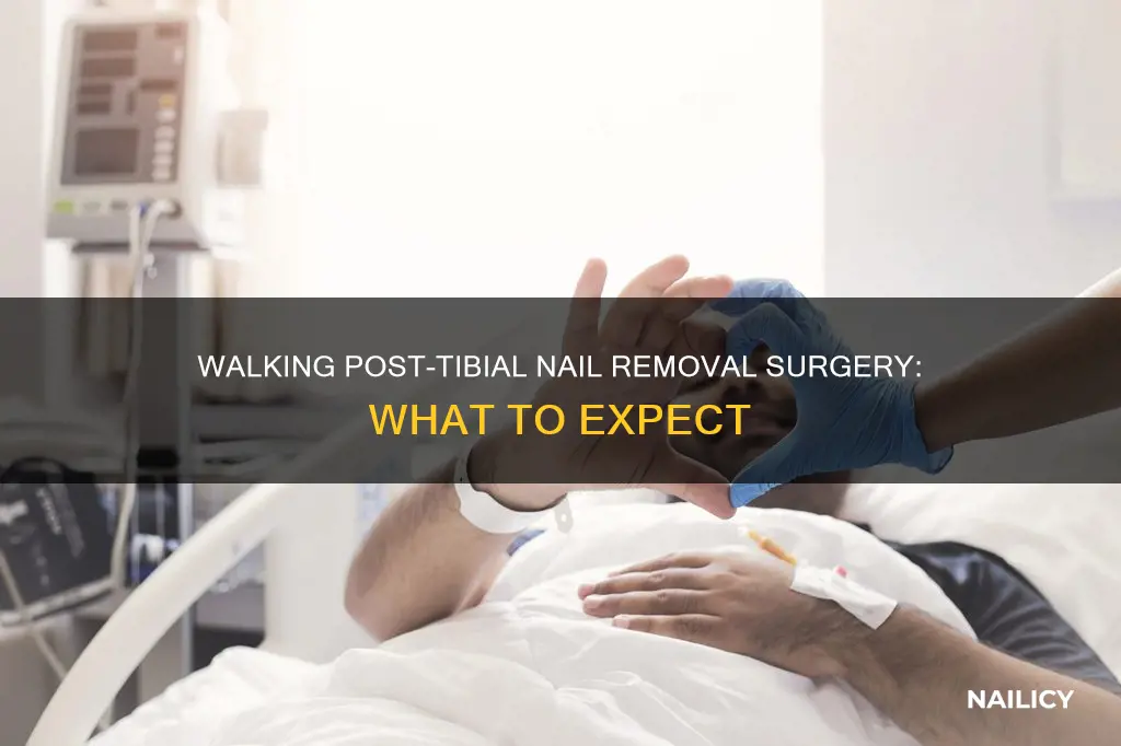 Walking Post-Tibial Nail Removal Surgery: What To Expect | Nailicy