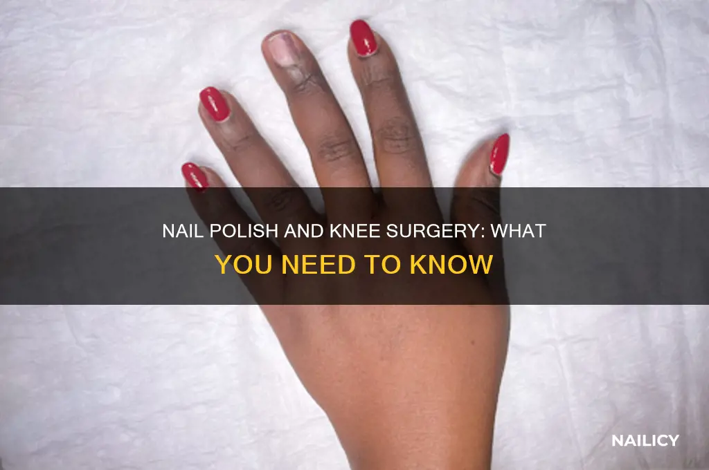 Nail Polish And Knee Surgery: What You Need To Know | Nailicy