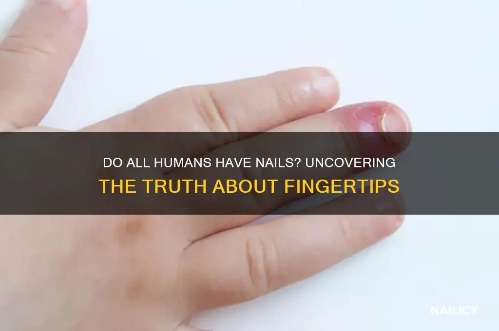 Do All Humans Have Nails? Uncovering The Truth About Fingertips | Nailicy