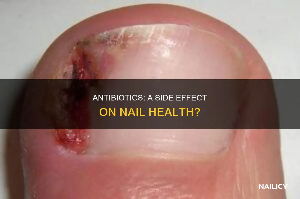 Antibiotics: A Side Effect On Nail Health? | Nailicy