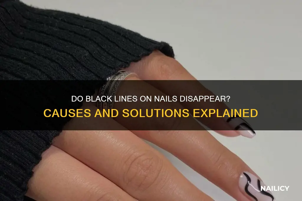 Do Black Lines On Nails Disappear? Causes And Solutions Explained | Nailicy