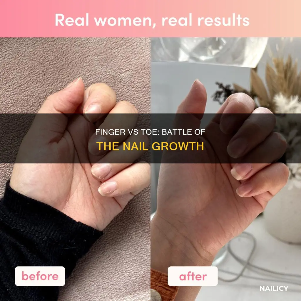 Finger Vs Toe: Battle Of The Nail Growth | Nailicy