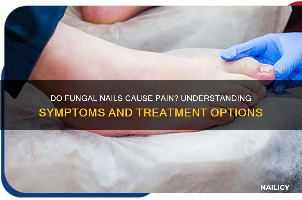 Do Fungal Nails Cause Pain? Understanding Symptoms And Treatment ...