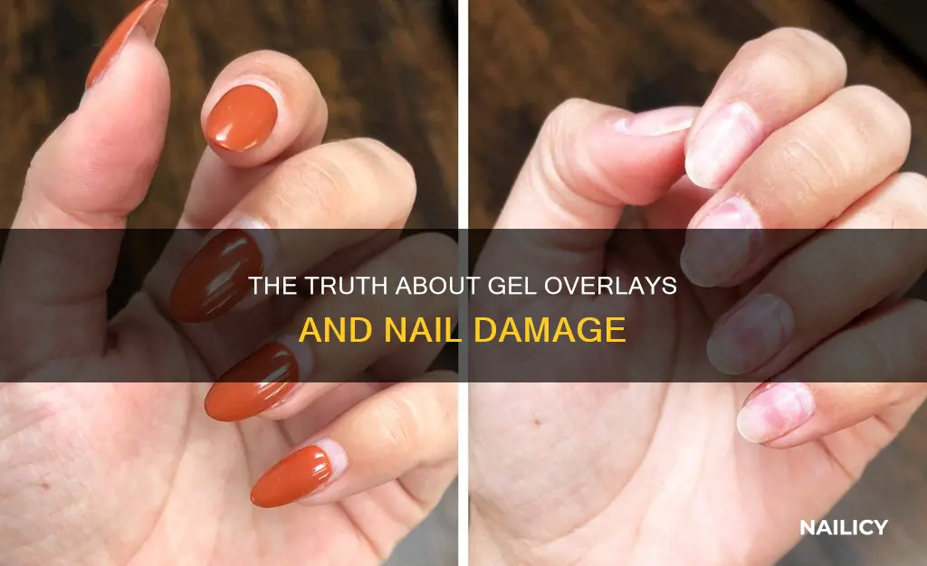 The Truth About Gel Overlays And Nail Damage | Nailicy