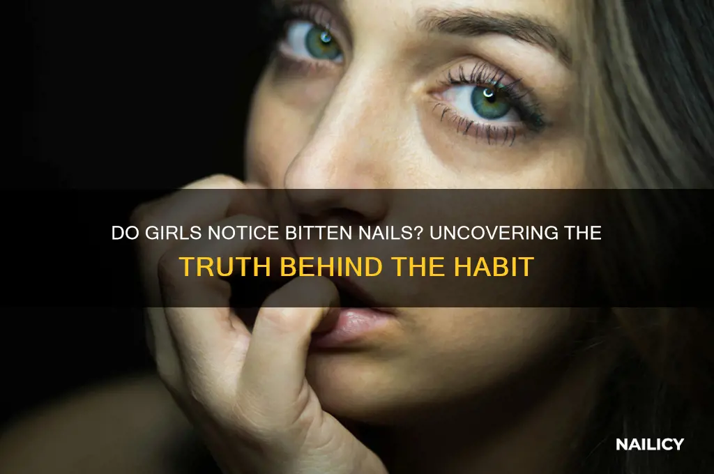 Do Girls Notice Bitten Nails? Uncovering The Truth Behind The Habit ...