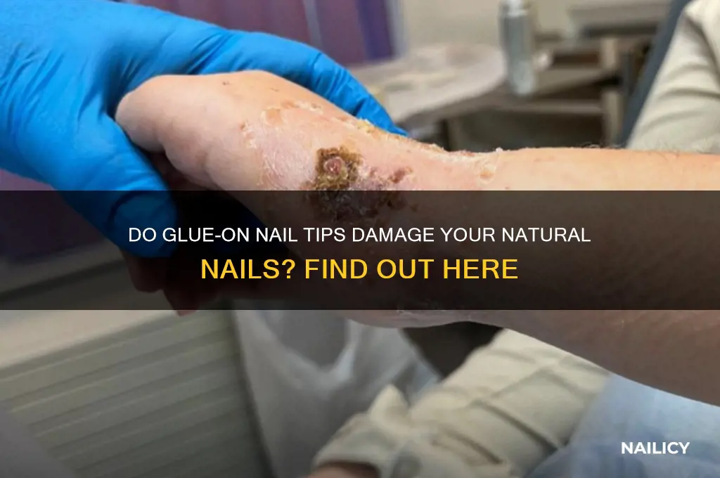 Does Nail Glue Damage Nails