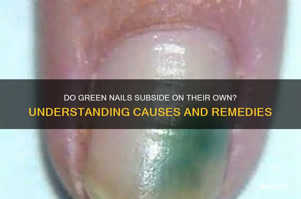 Do Green Nails Subside On Their Own? Understanding Causes And Remedies ...