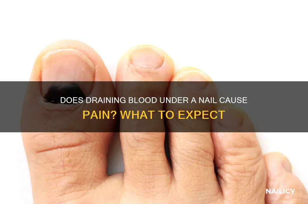Does Draining Blood Under A Nail Cause Pain? What To Expect | Nailicy