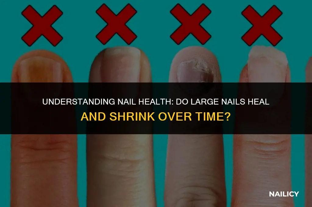 Understanding Nail Health: Do Large Nails Heal And Shrink Over Time ...
