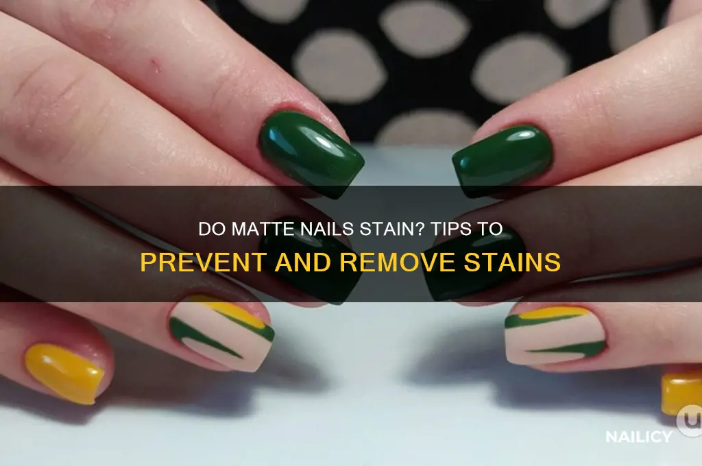 Do Matte Nails Stain? Tips To Prevent And Remove Stains | Nailicy