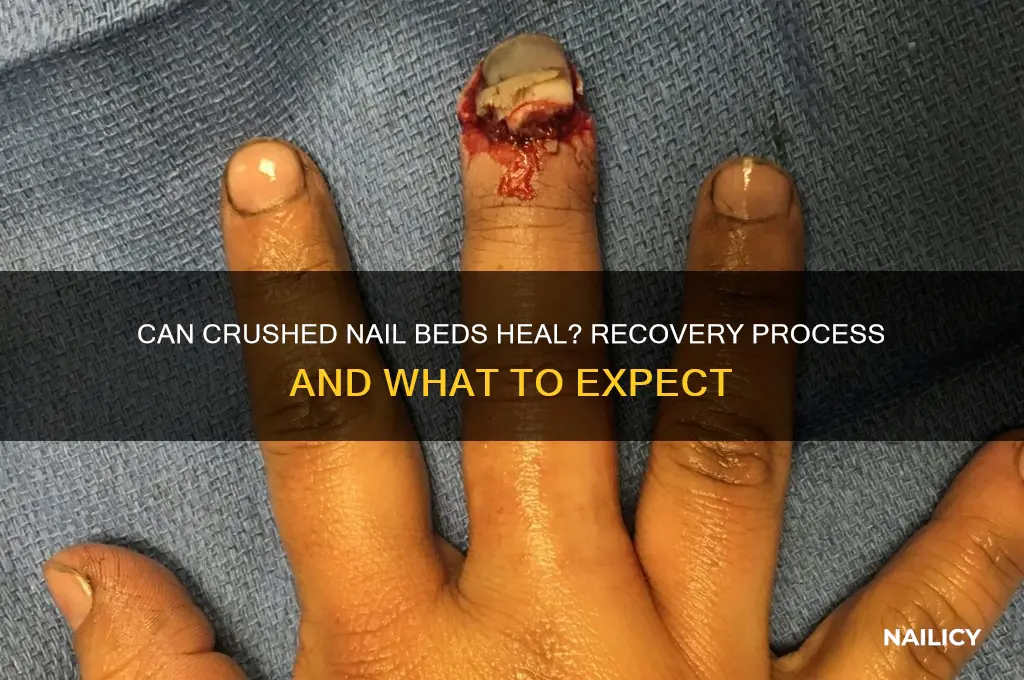 Can Crushed Nail Beds Heal? Recovery Process And What To Expect | Nailicy