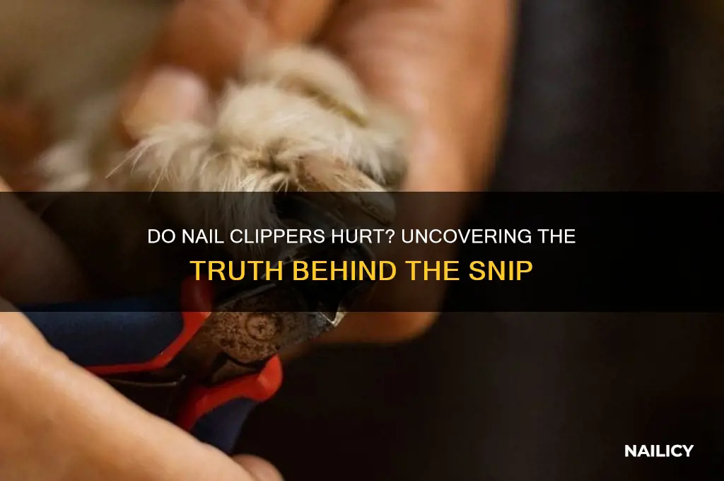 Do Nail Clippers Hurt? Uncovering The Truth Behind The Snip | Nailicy