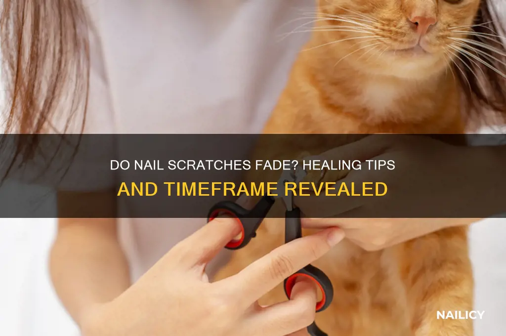 Do Nail Scratches Fade? Healing Tips And Timeframe Revealed | Nailicy