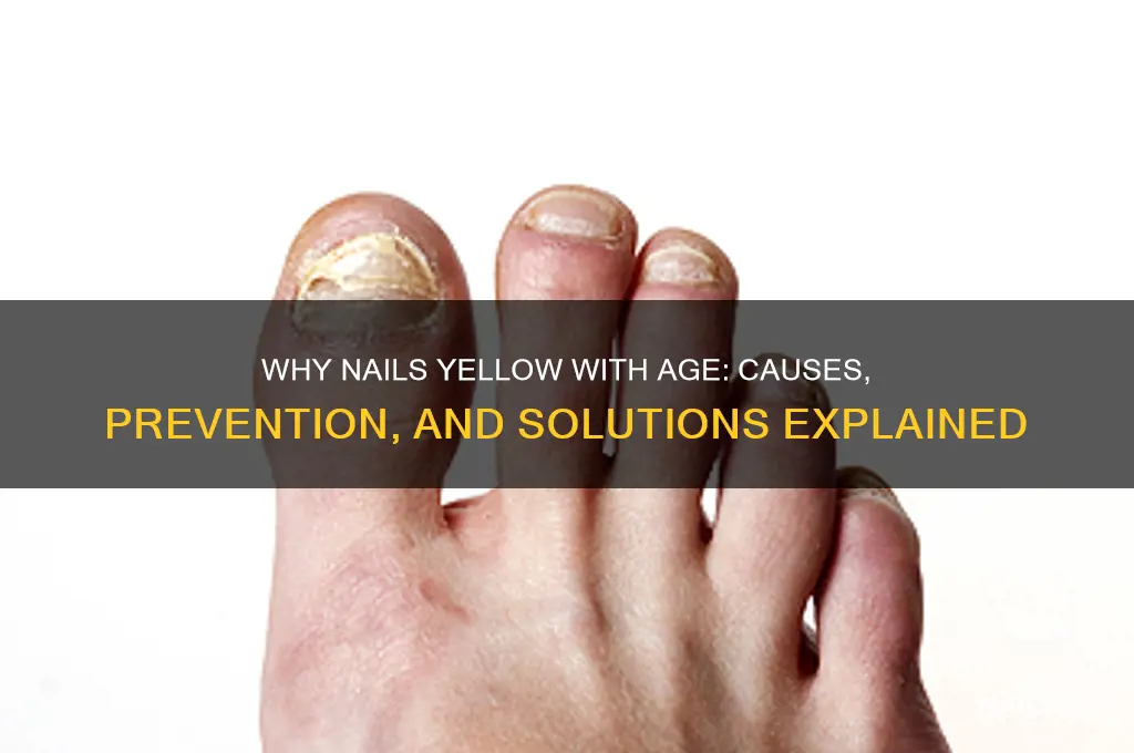 Why Nails Yellow With Age: Causes, Prevention, And Solutions Explained ...