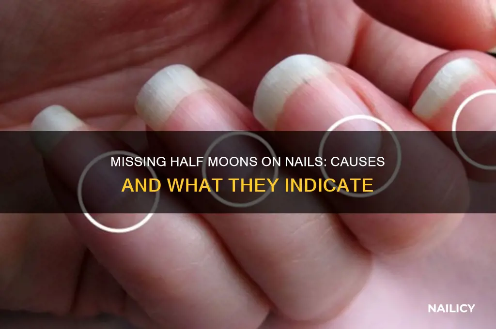Missing Half Moons On Nails: Causes And What They Indicate | Nailicy