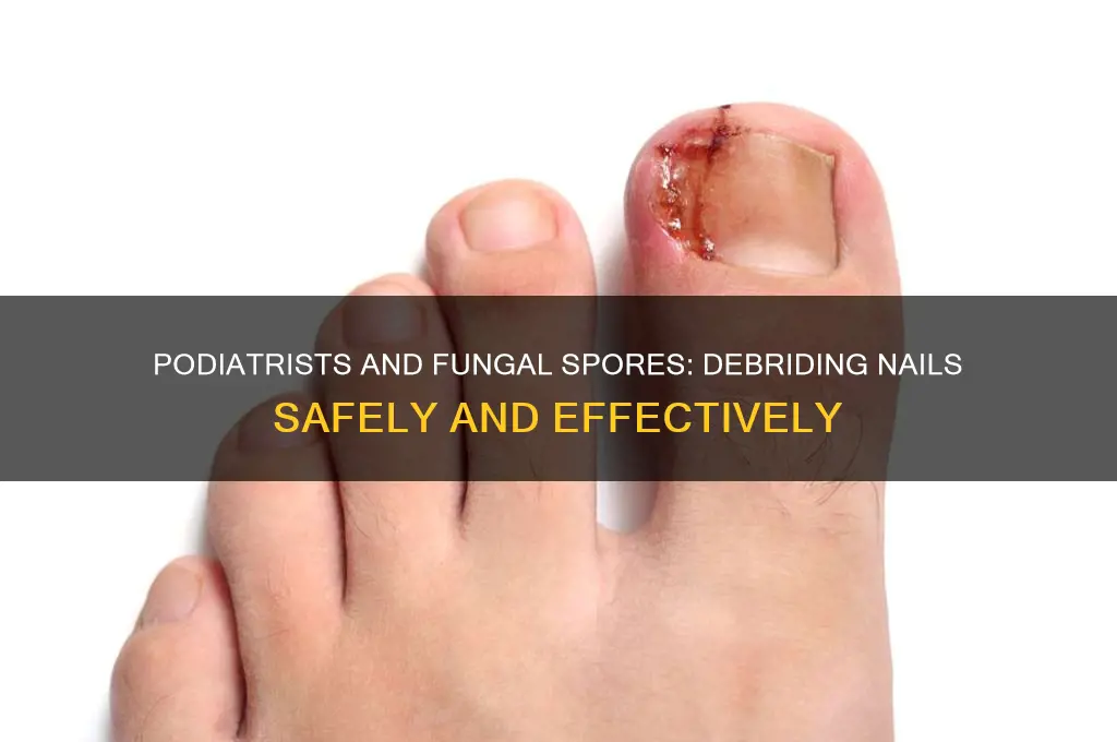 Podiatrists And Fungal Spores: Debriding Nails Safely And Effectively ...