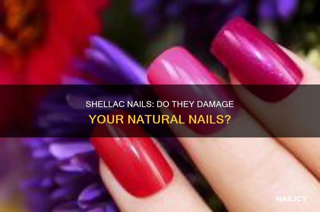 Shellac Nails: Do They Damage Your Natural Nails? | Nailicy