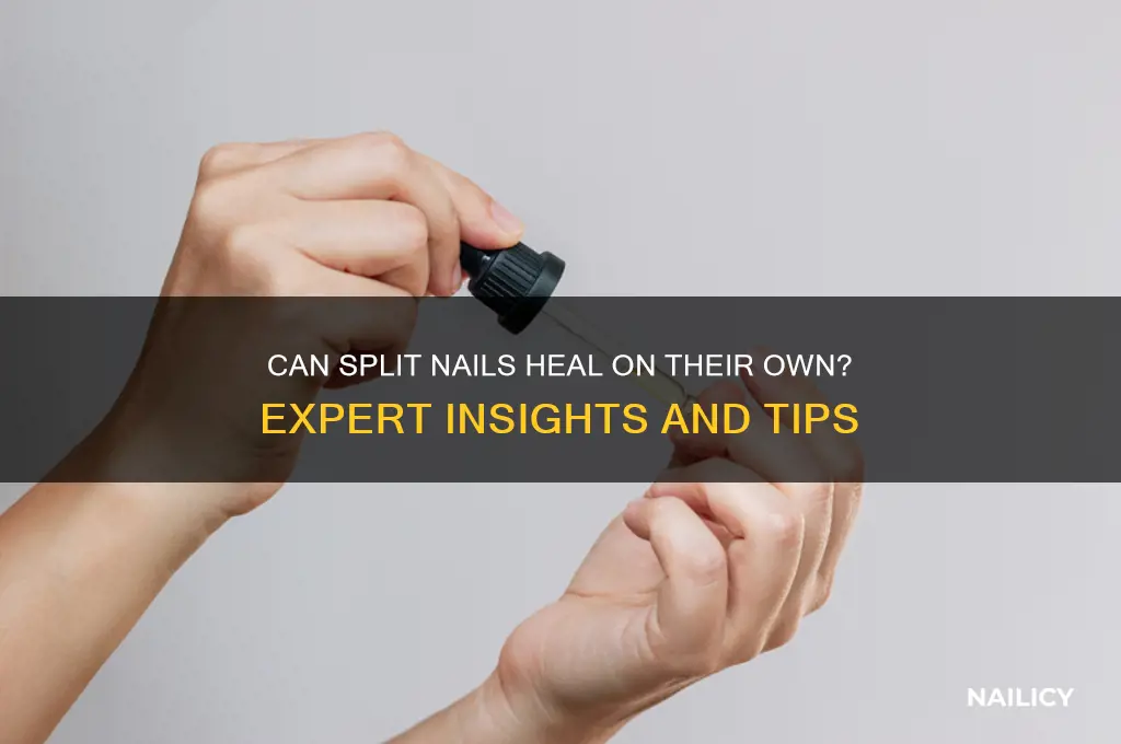 Can Split Nails Heal On Their Own? Expert Insights And Tips | Nailicy