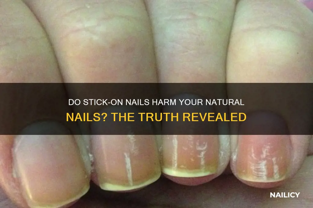 Do Stick-On Nails Harm Your Natural Nails? The Truth Revealed | Nailicy